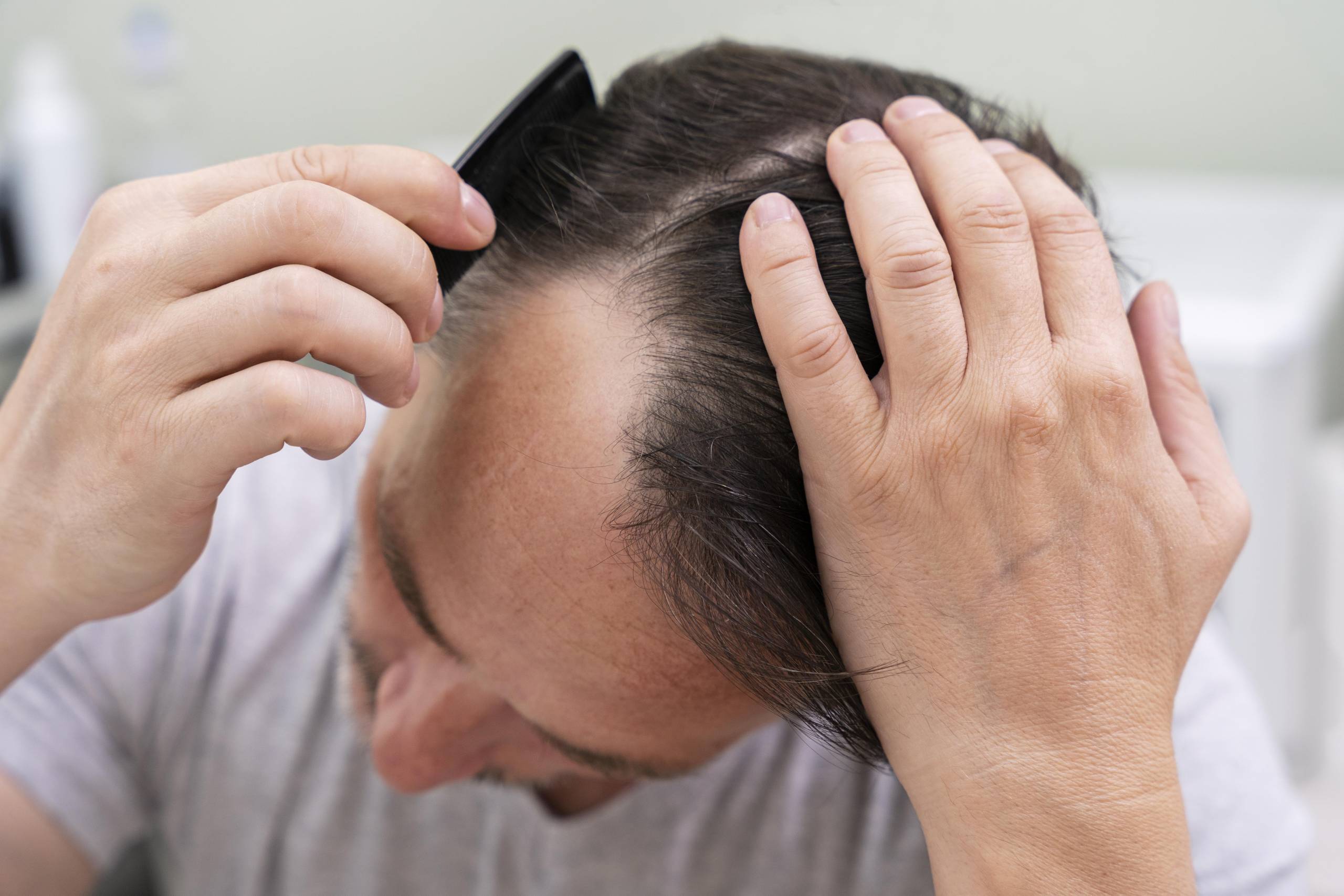 Effective Hair Loss Treatment In Kerala - Dr.Skin Clinics